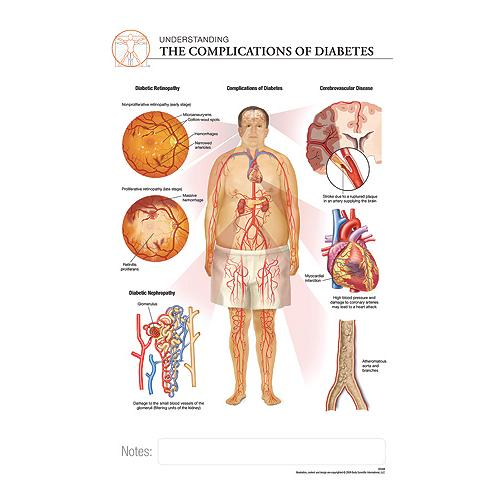 Fischer Technical Company BS328 – Complications of "Post It" Chart ...